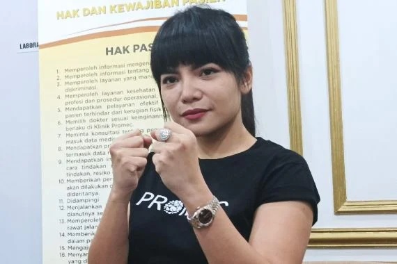 Dinar Candy Berhenti Main Sosmed - Tangerang Raya